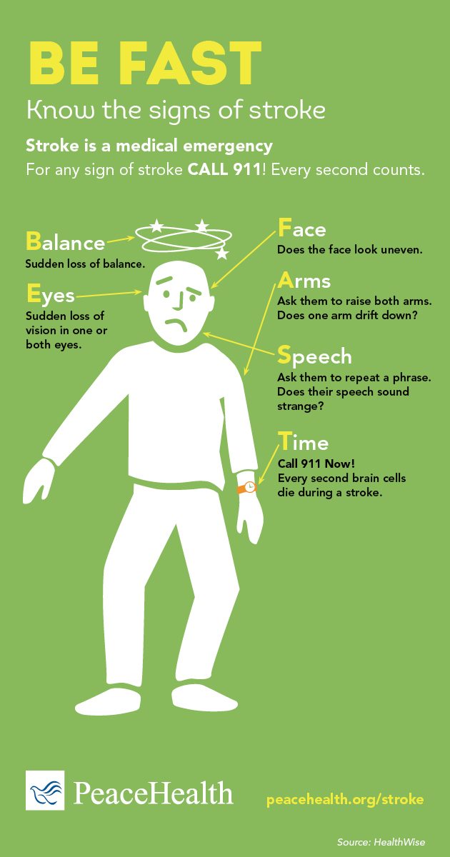 Infographic: Signs of a stroke | PeaceHealth